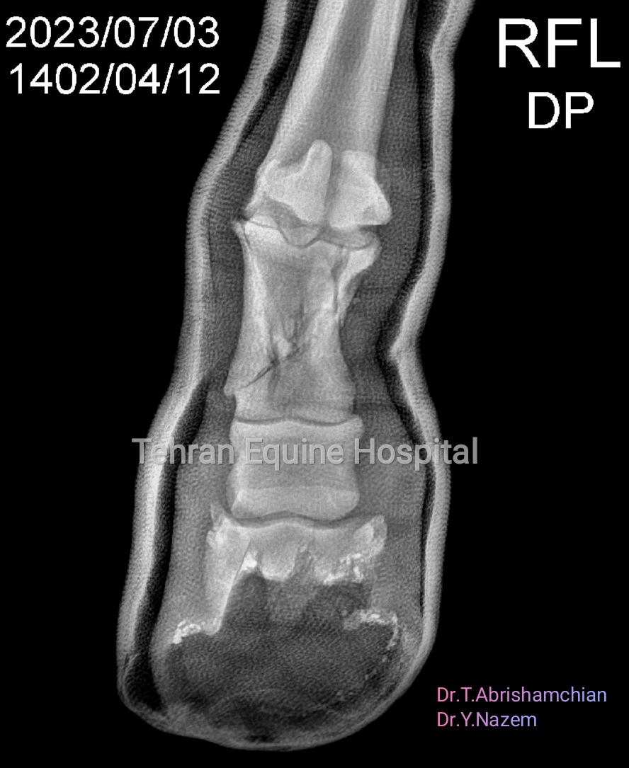 Proximal Phalanx Fracture – Tehran Equine Hospital