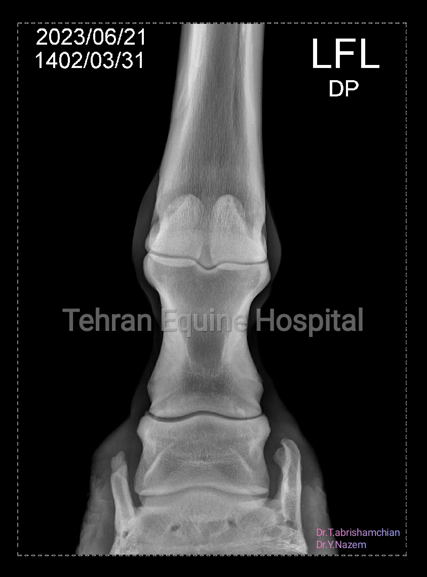 Ossification of angular cartilage(side bone) – Tehran Equine Hospital