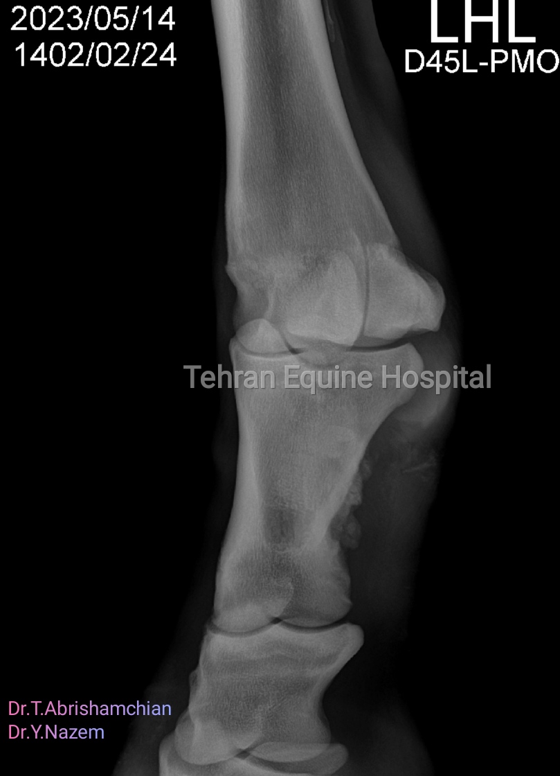 Palisading new bone formation in proximal phalanx caused by trauma ...